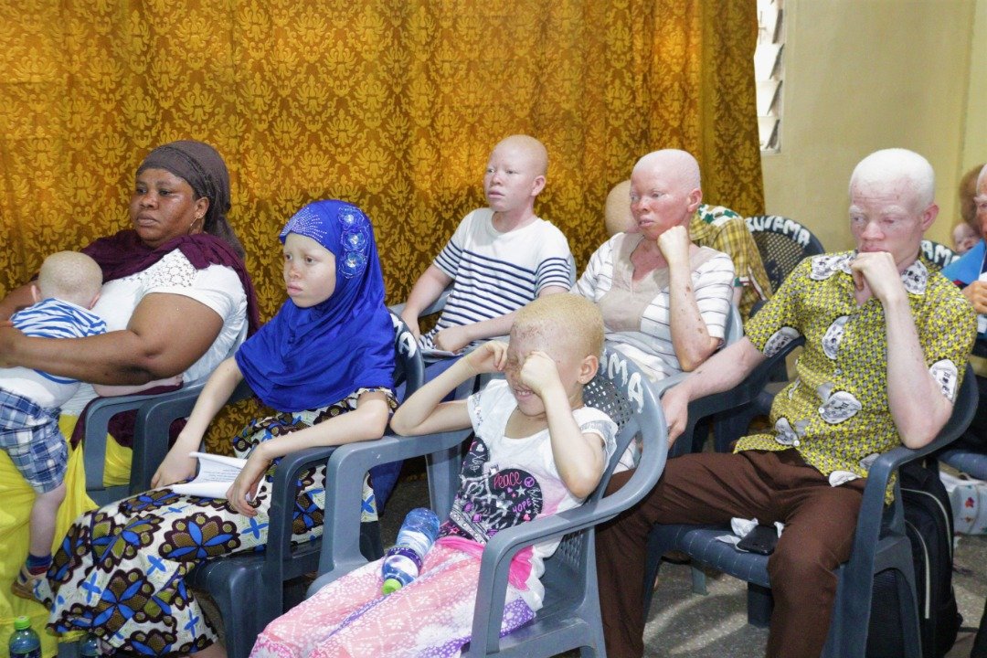 ENA embarks on skin cancer awareness campaign for persons with albinism ...